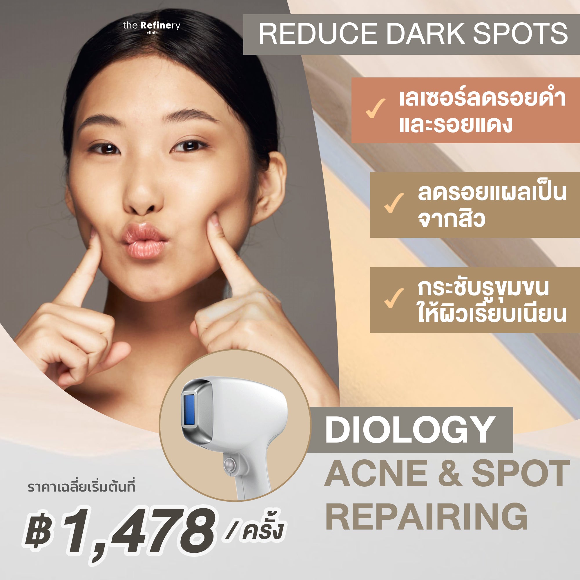 Diology Acne & Spots Repairing (เลเซอร์บำรุงผิว ลดรอยดำ รอยแดง และรอย ...